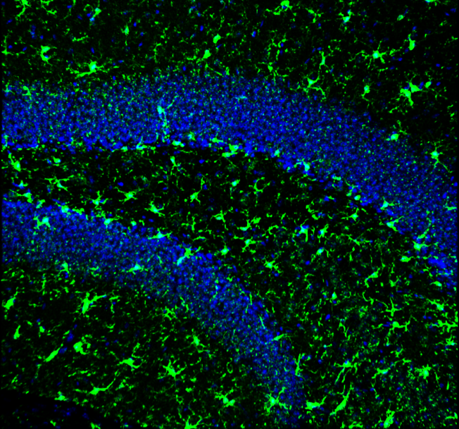 GSI - The Impact of Galactic Cosmic Radiation on the Central Nervous System