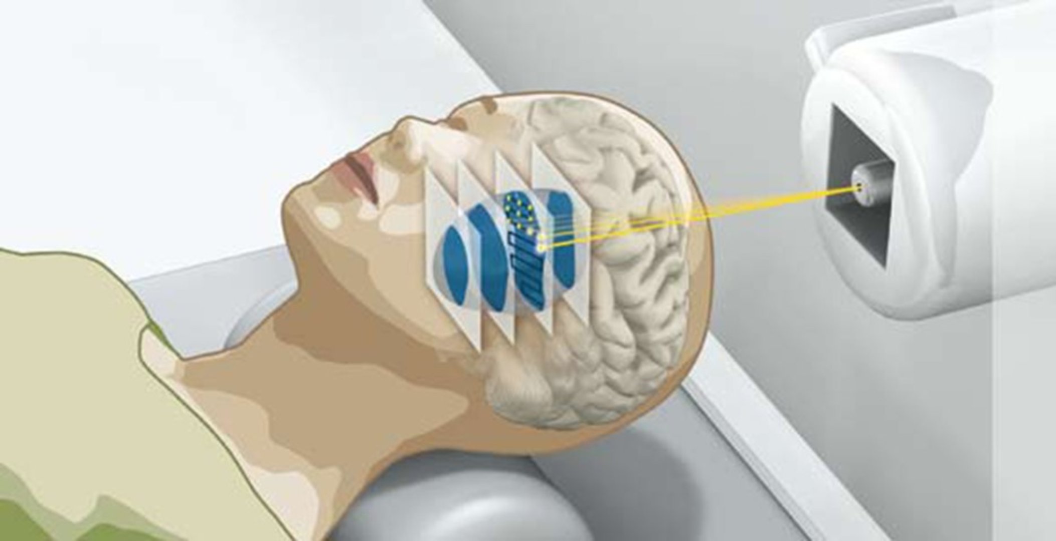 GSI - Particle Therapy Physics