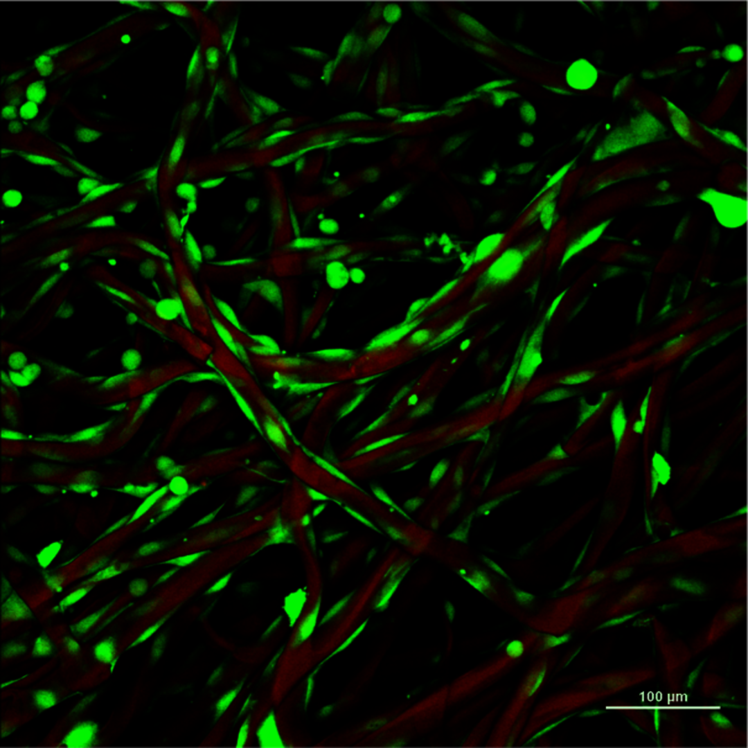 GSI - Clinical Radiobiology